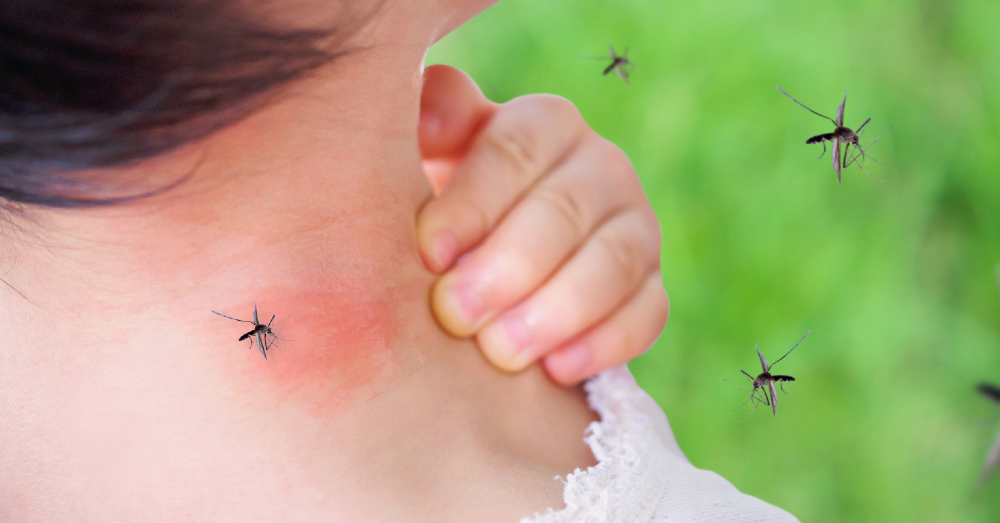 Why Some People Get Bitten By Mosquitoes More Than Others